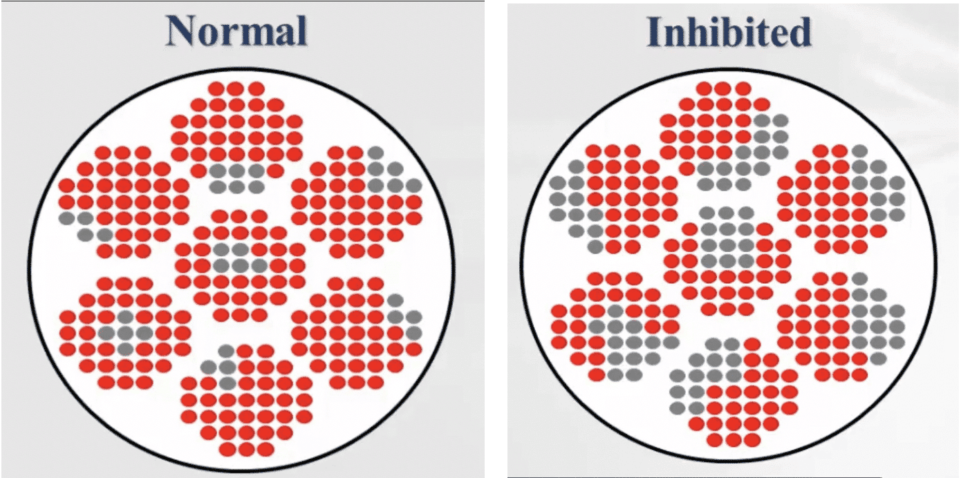 Le flessum du genou : origine neuromotrice et solutions rééducatives