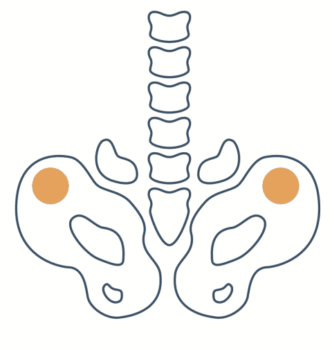 Traitement des pathologies du coude : tendinite, flessum