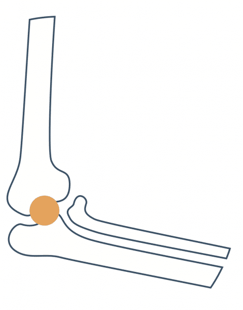 Traitement du genou : syndrôme rotulien, flessum du genou