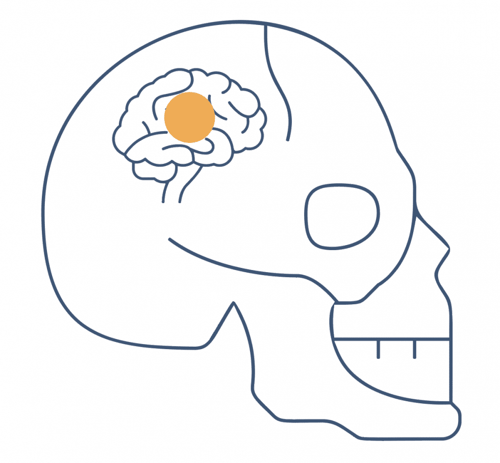 Traitement des pathologies du coude : tendinite, flessum